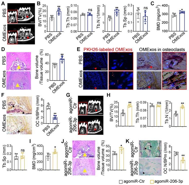 GATA4-driven miR-206-3p signatures control orofacial bone development ...