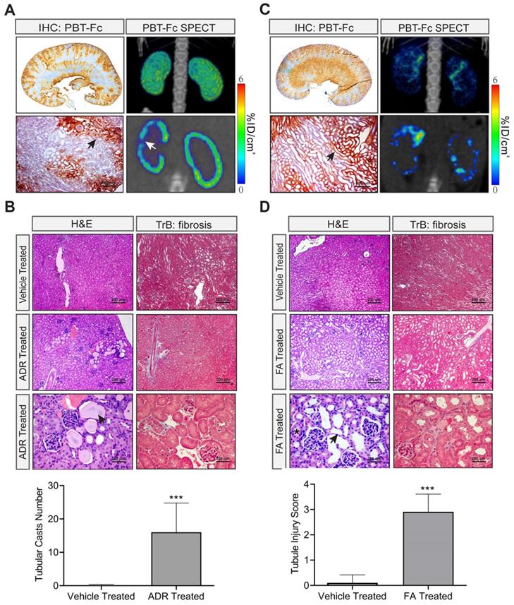 Targeted design of a recombinant tracer for SPECT renal imaging