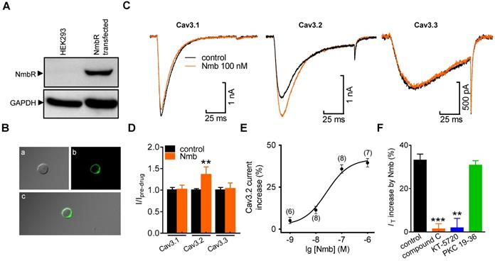 Neuromedin B receptor stimulation of Cav3.2 T-type Ca2+ channels in ...