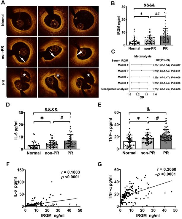 IRGM/Irgm1 facilitates macrophage apoptosis through ROS generation and ...