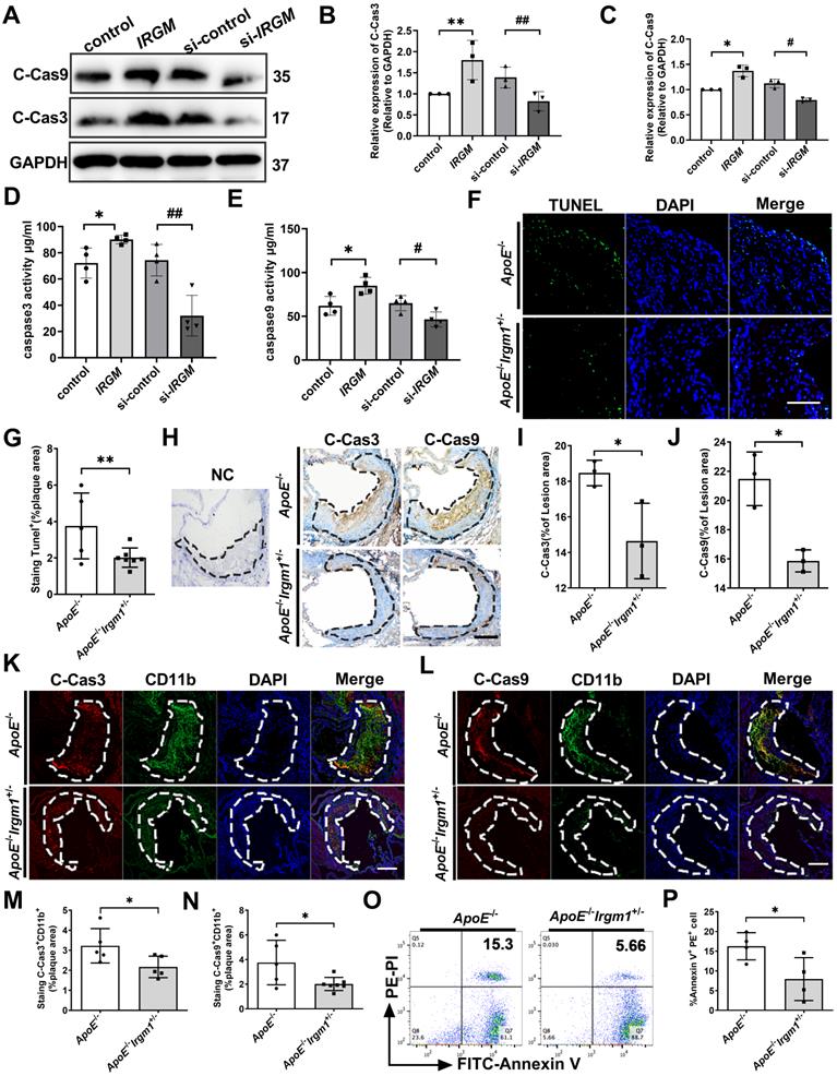 IRGM/Irgm1 facilitates macrophage apoptosis through ROS generation and ...
