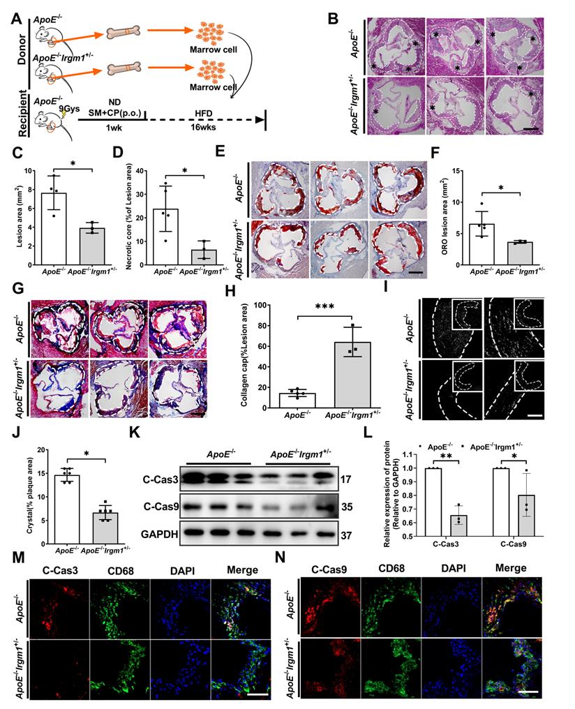 IRGM/Irgm1 facilitates macrophage apoptosis through ROS generation and ...