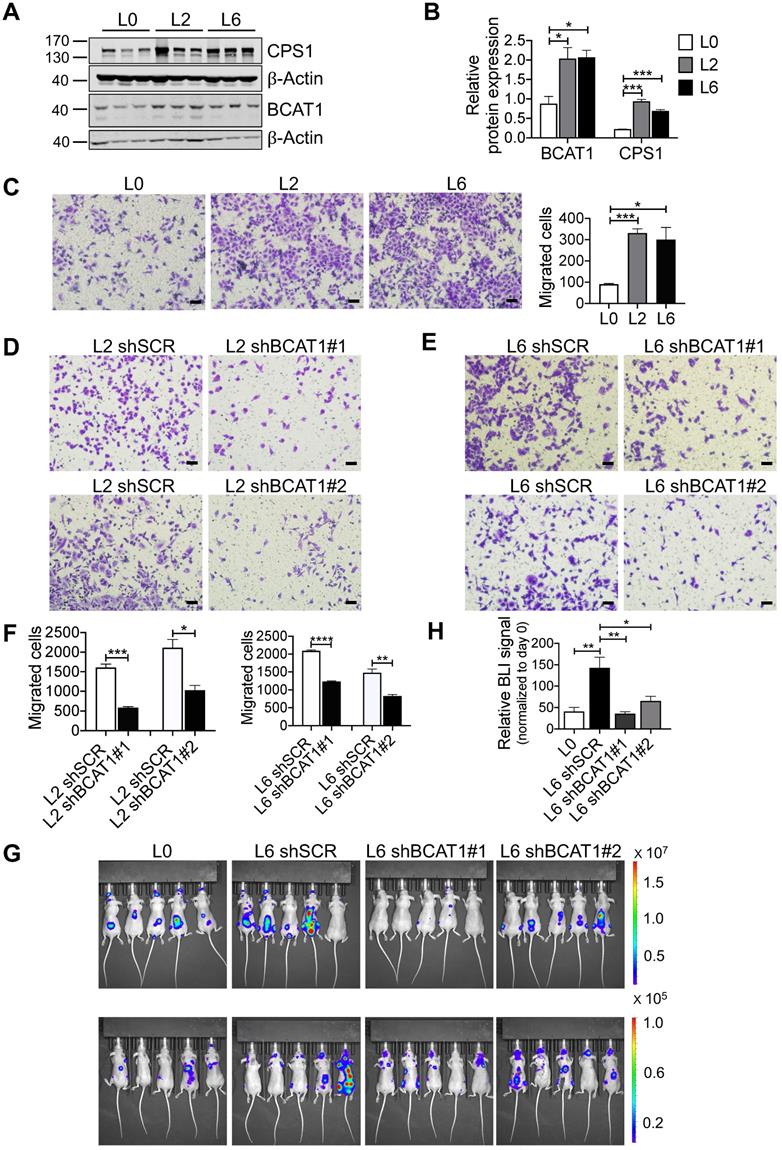 Proteomic analysis of lung cancer cells reveals a critical role of ...