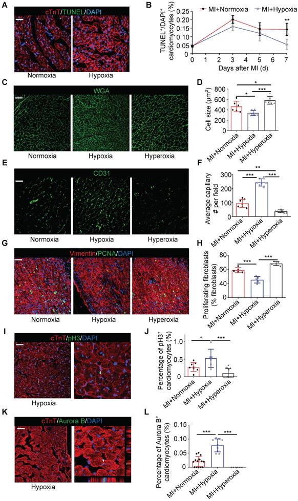 Hypoxia-primed monocytes/macrophages enhance postinfarction myocardial ...