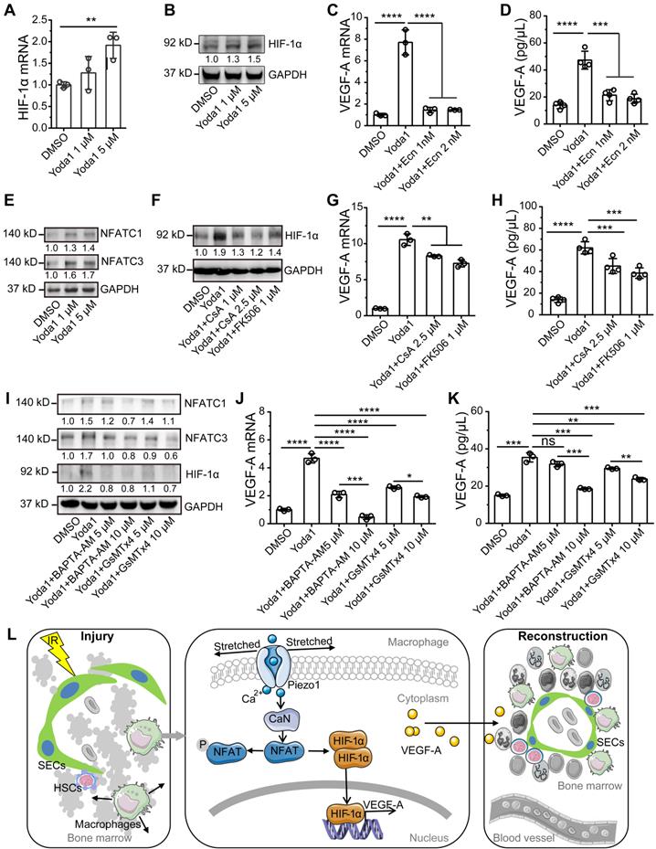 Piezo1-mediated mechanosensation in bone marrow macrophages promotes ...