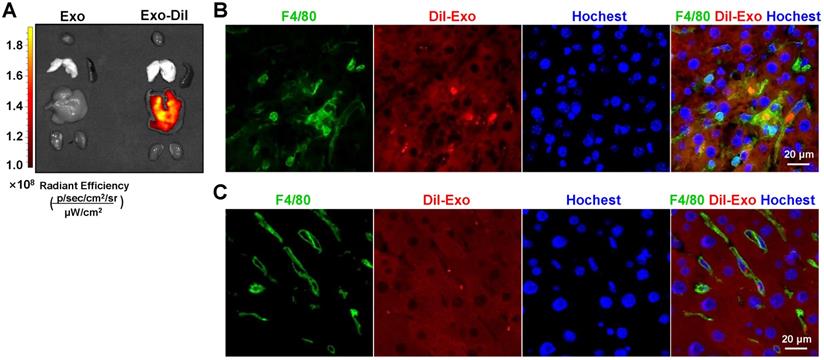 Exosome-mediated delivery of RBP-J decoy oligodeoxynucleotides ...