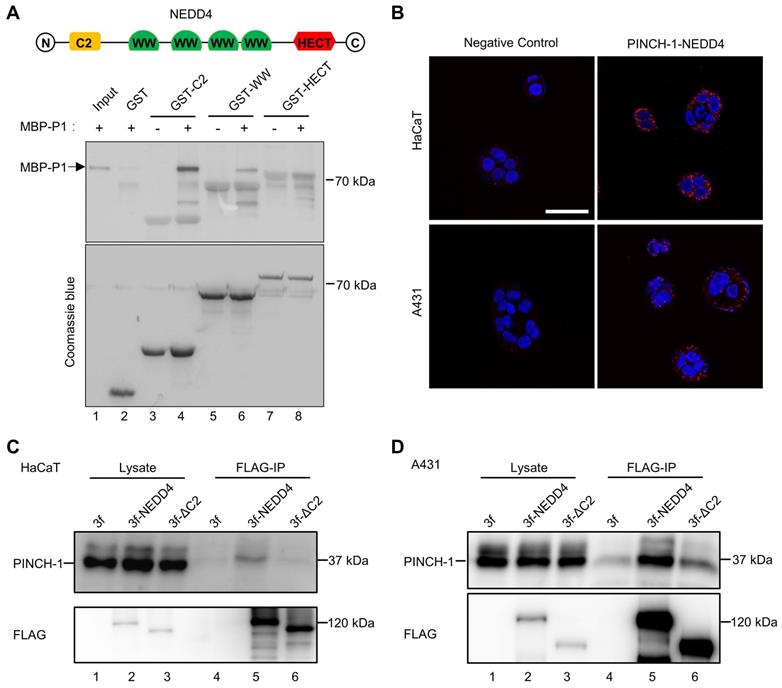PINCH-1 promotes IGF-1 receptor expression and skin cancer progression ...