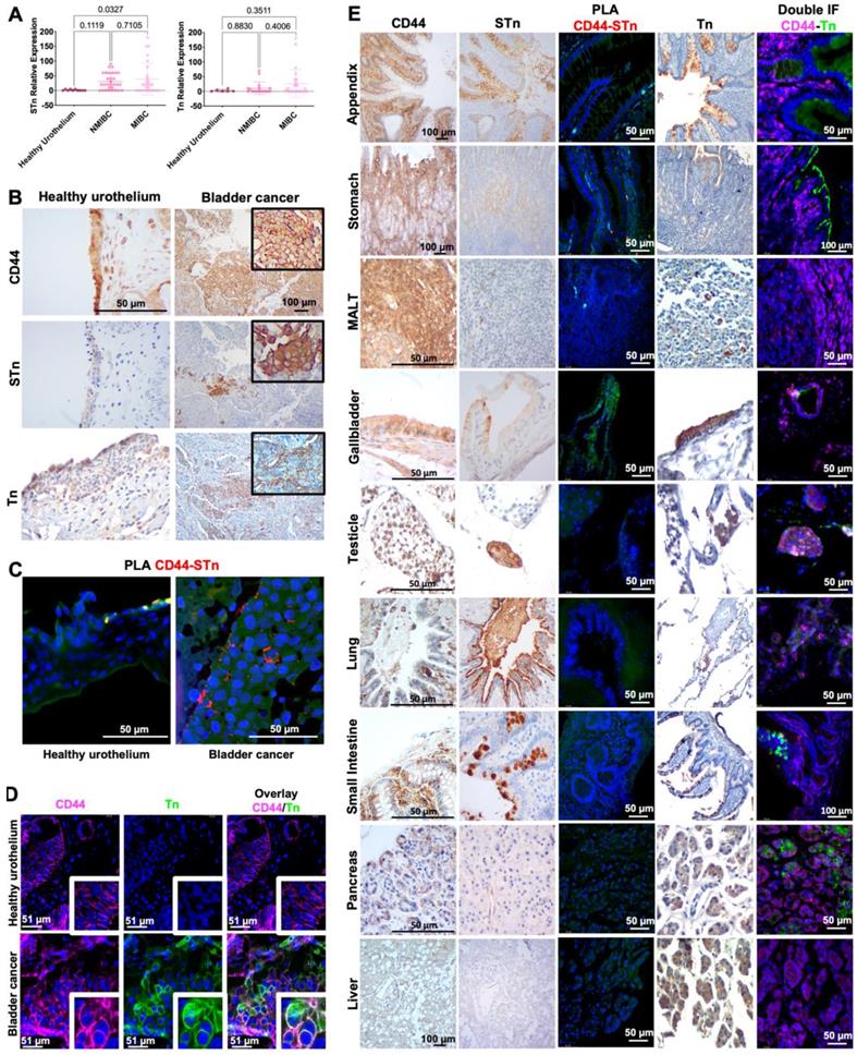 Glycoproteogenomics characterizes the CD44 splicing code associated ...
