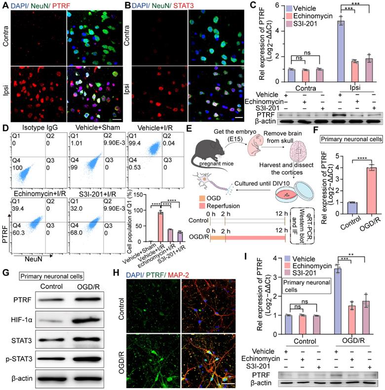 Neuronal STAT3/HIF-1α/PTRF axis-mediated bioenergetic disturbance ...