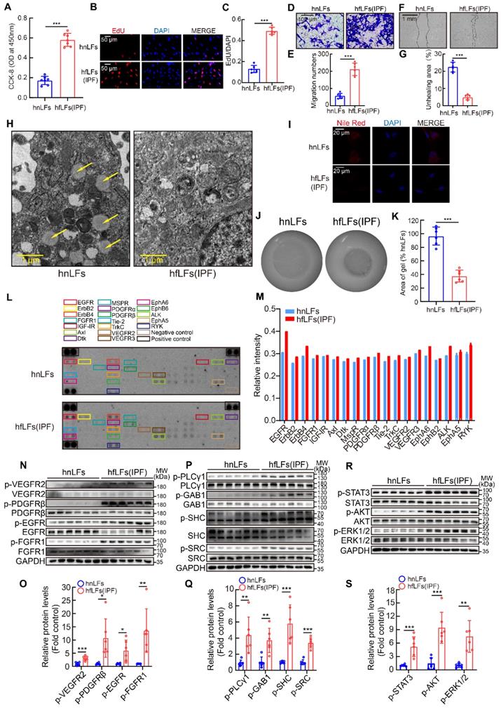 Blockade of phosphotyrosine pathways suggesting SH2 superbinder as a ...