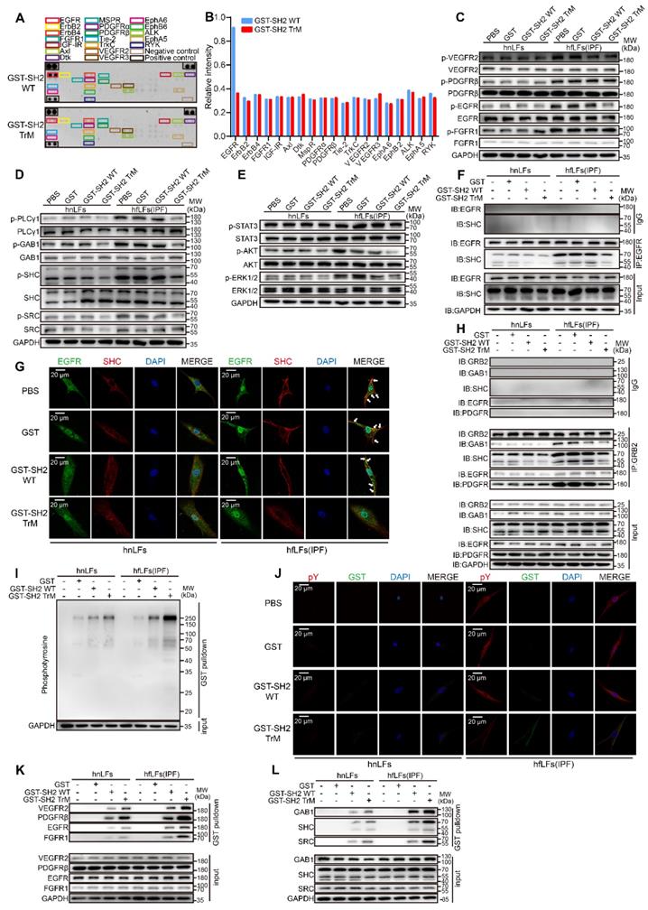 Blockade of phosphotyrosine pathways suggesting SH2 superbinder as a ...