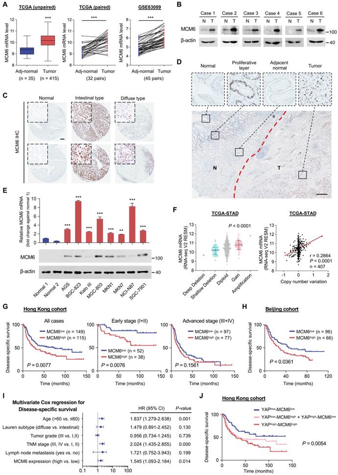 MCM6 is a critical transcriptional target of YAP to promote gastric ...