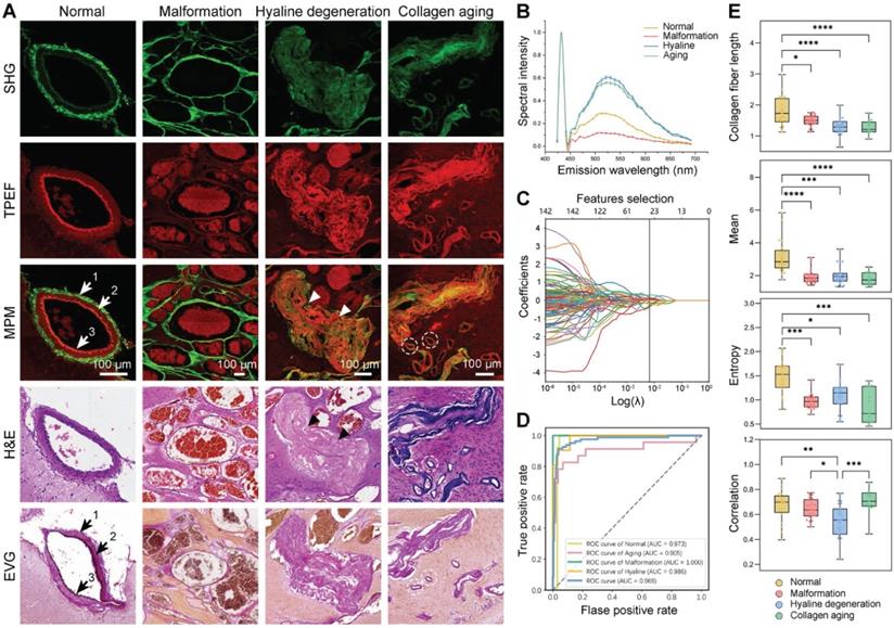 Resection-inspired histopathological diagnosis of cerebral cavernous ...