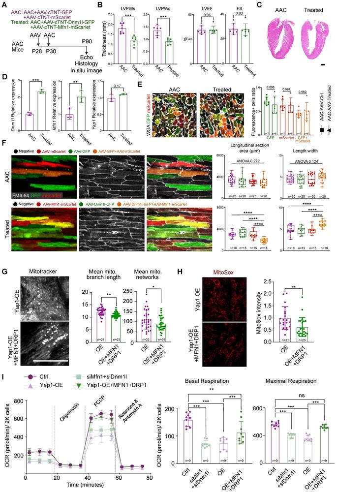 Yap1 modulates cardiomyocyte hypertrophy via impaired mitochondrial ...