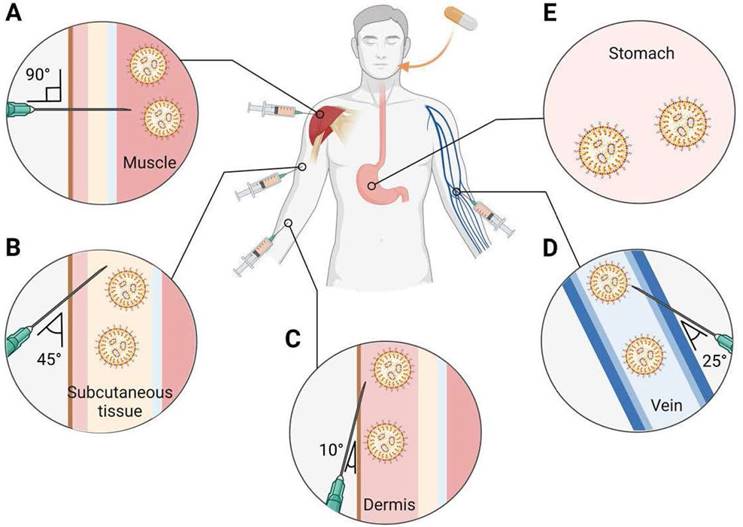Lipid nanoparticles for delivery of RNA therapeutics: Current status ...