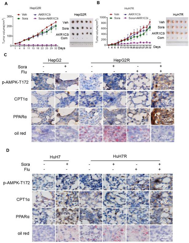 AKR1C3-dependent lipid droplet formation confers hepatocellular ...