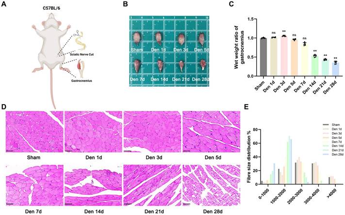 Ablation of NLRP3 inflammasome attenuates muscle atrophy via inhibiting ...