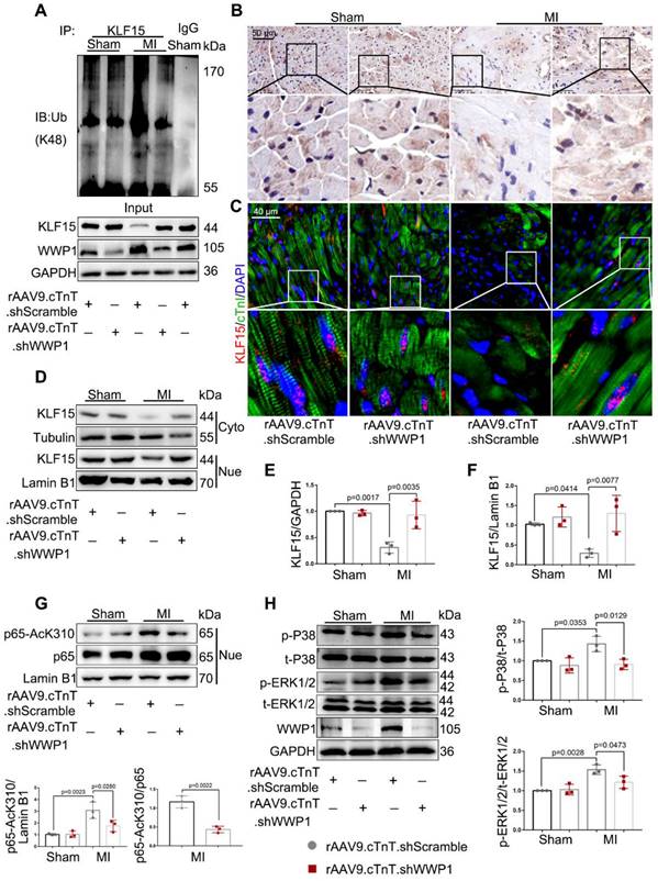 Targeting WWP1 ameliorates cardiac ischemic injury by suppressing KLF15 ...