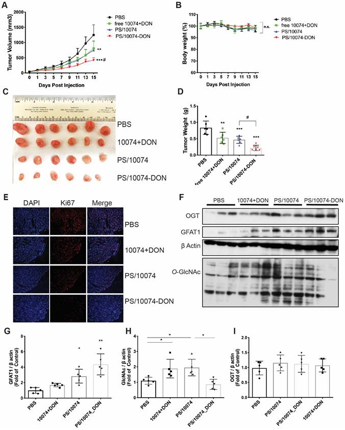 Improved antitumor activity against prostate cancer via synergistic ...