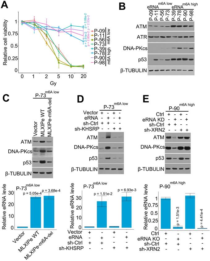 Enhancer RNA promotes resistance to radiotherapy in bone-metastatic ...