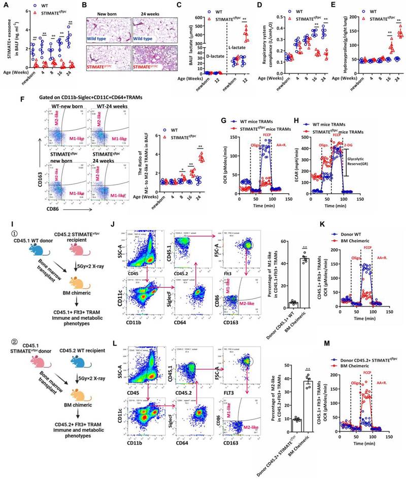 Exosomal STIMATE derived from type II alveolar epithelial cells ...