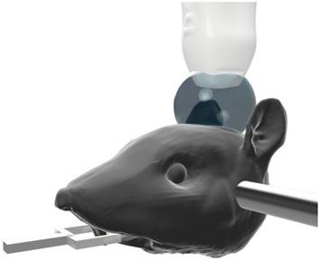 Non-invasive transcranial volumetric ultrasound localization microscopy ...