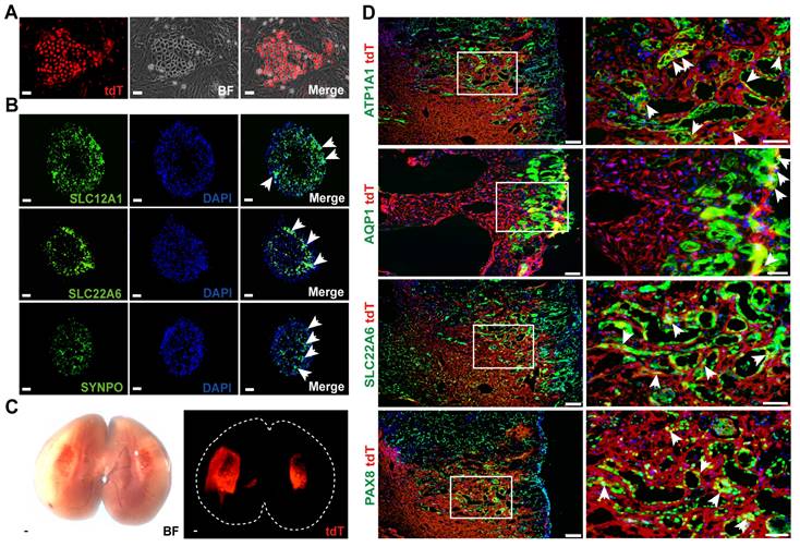 WT1+ glomerular parietal epithelial progenitors promote renal proximal ...