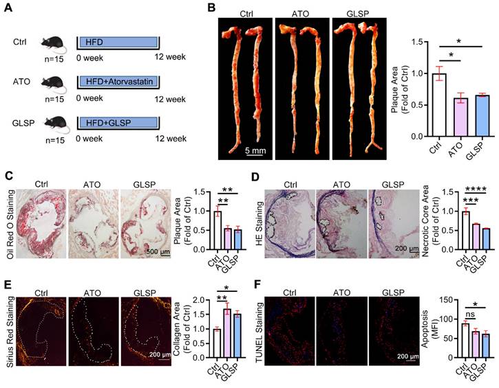 GLSP and GLSP-derived triterpenes attenuate atherosclerosis and aortic ...