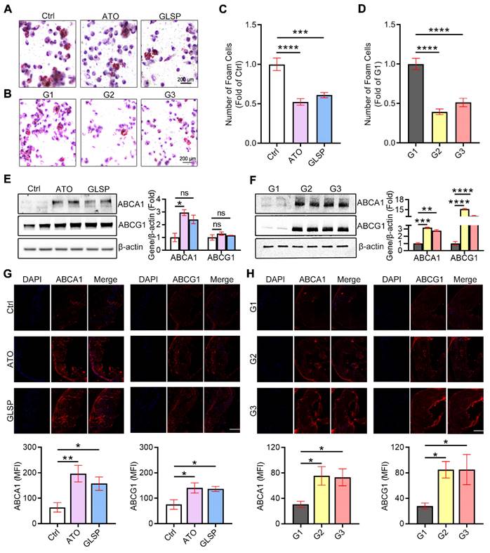 GLSP and GLSP-derived triterpenes attenuate atherosclerosis and aortic ...