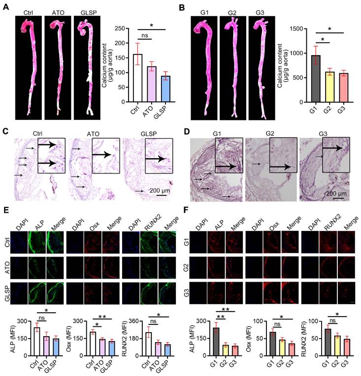 GLSP and GLSP-derived triterpenes attenuate atherosclerosis and aortic ...