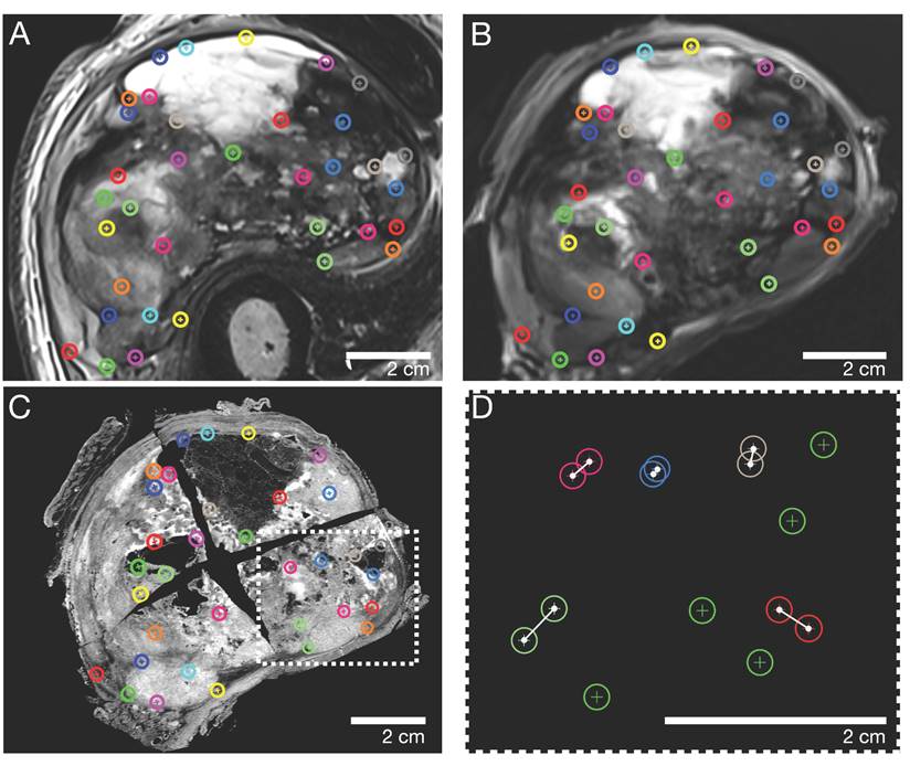 Multiparametric magnetic resonance imaging for radiation therapy ...