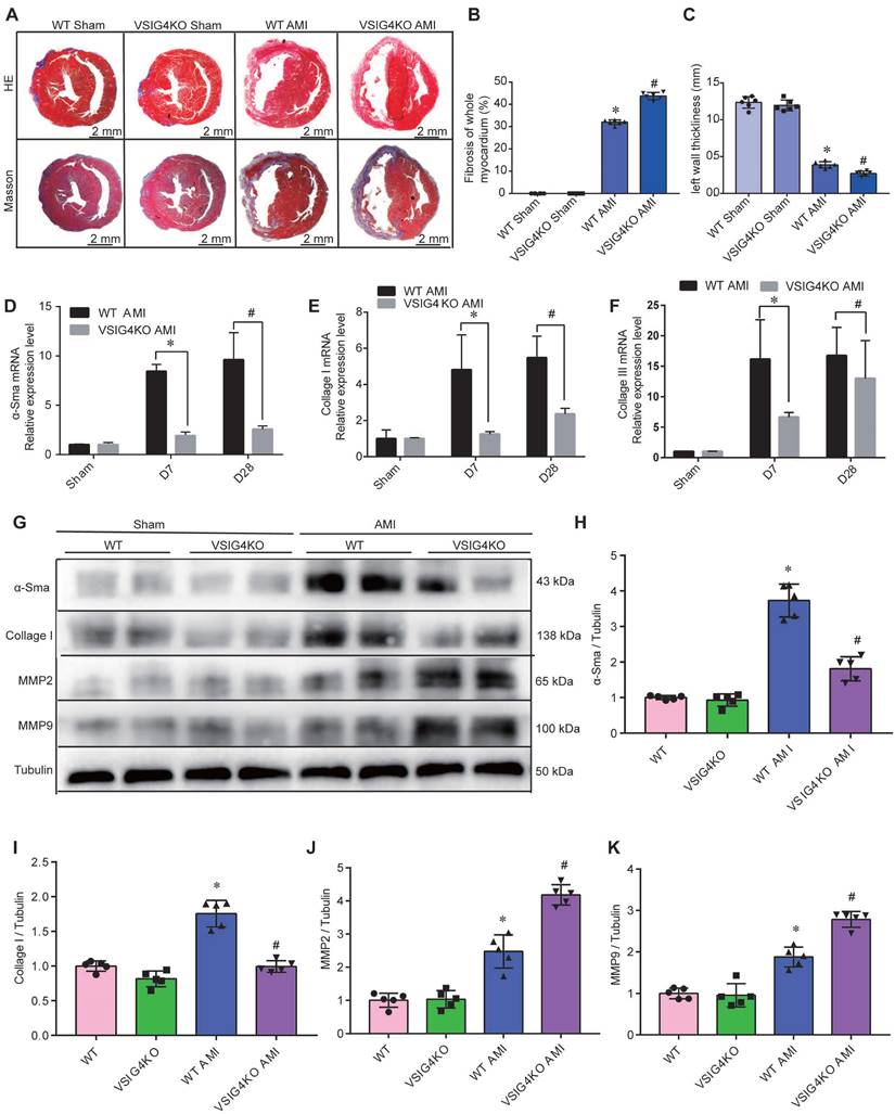 Hypoxia Induces M2 Macrophages to Express VSIG4 and Mediate Cardiac ...