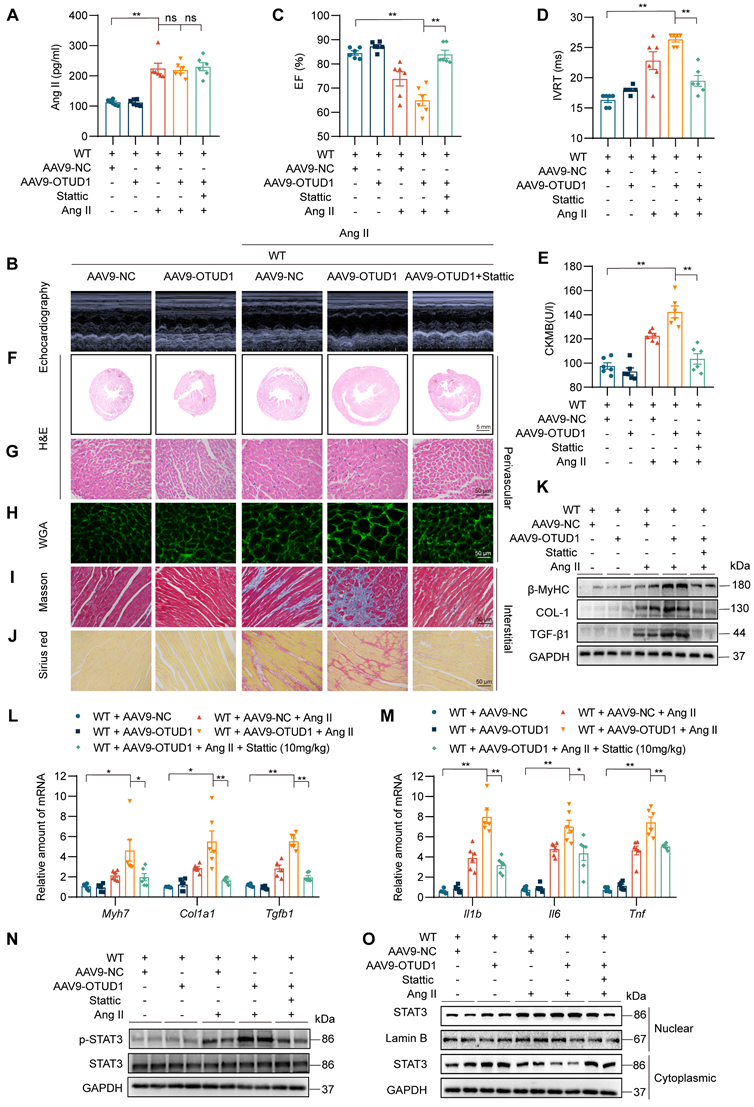 OTUD1 promotes pathological cardiac remodeling and heart failure by ...