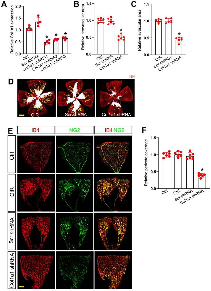 Single-cell RNA sequencing reveals a unique pericyte type associated ...