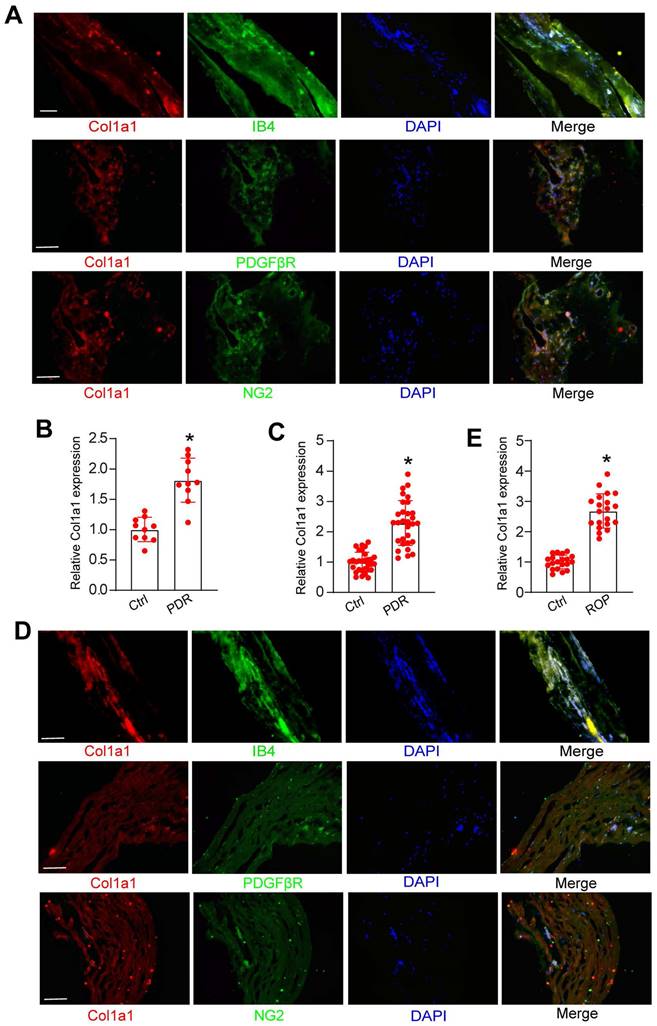Single-cell RNA sequencing reveals a unique pericyte type associated ...