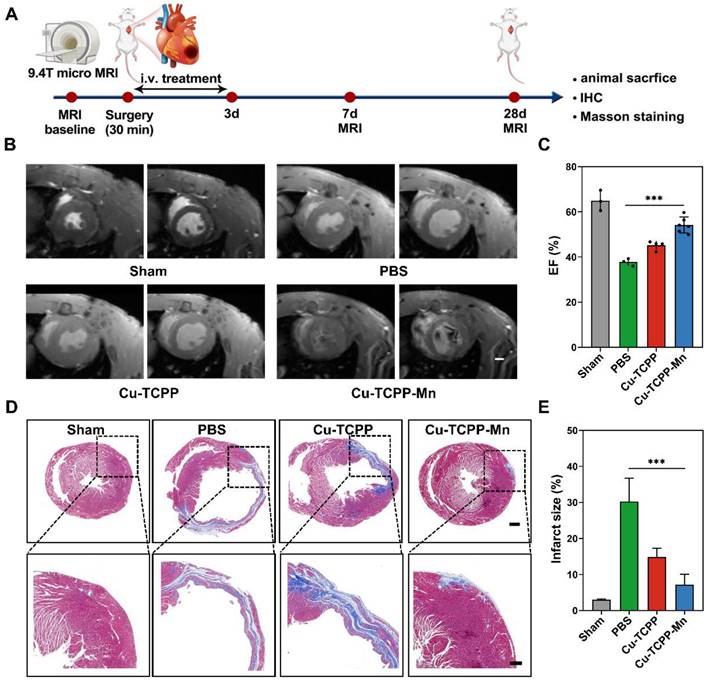 MOF-derived bimetallic nanozyme to catalyze ROS scavenging for ...