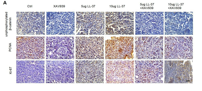 Myeloid cell-derived LL-37 promotes lung cancer growth by activating ...