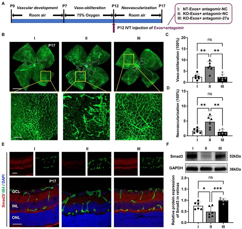 Tsp-1+ microglia attenuate retinal neovascularization by maintaining ...
