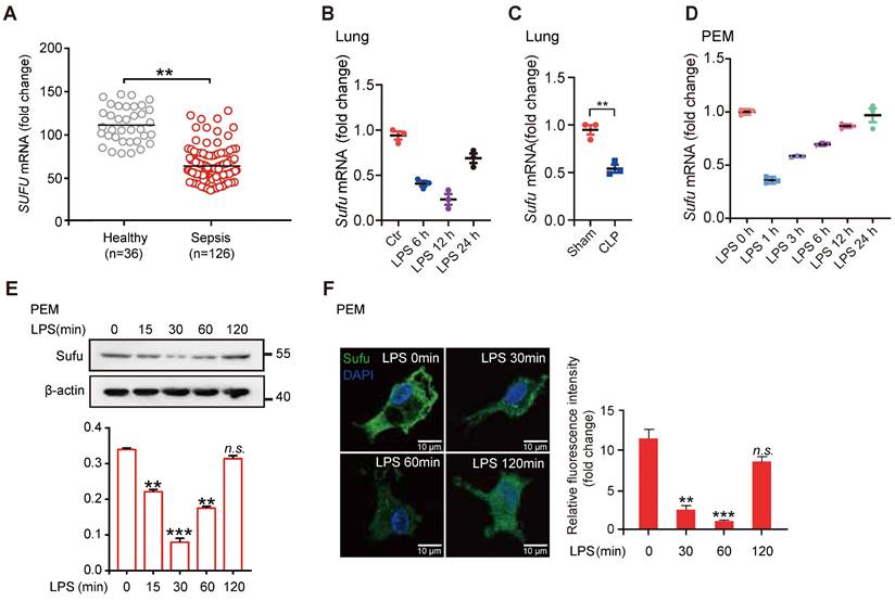 Sufu limits sepsis-induced lung inflammation via regulating phase ...