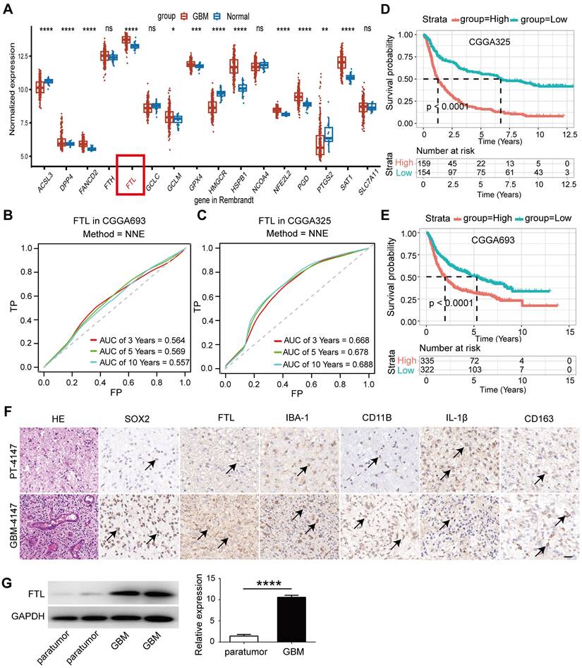 Ferritin light chain promotes the reprogramming of glioma immune ...