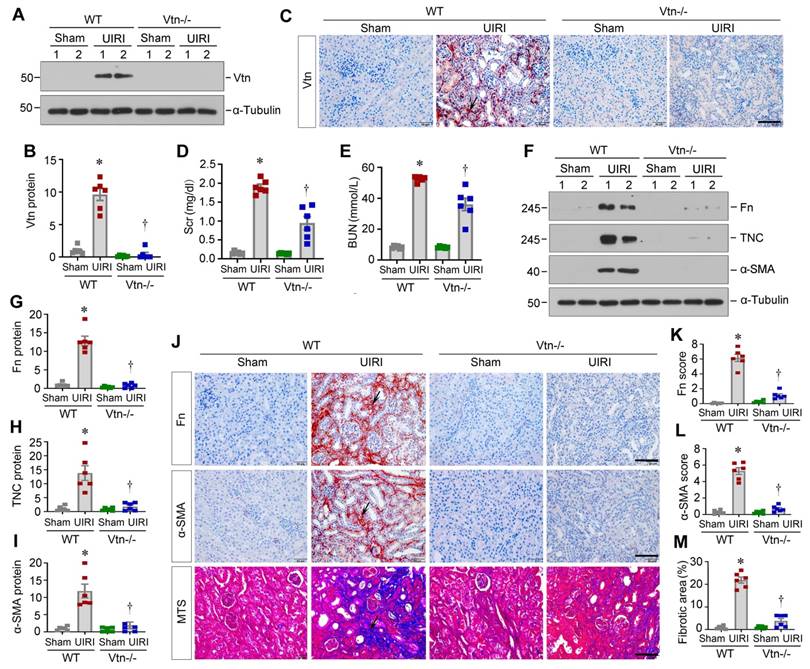 Macrophage promotes fibroblast activation and kidney fibrosis by ...
