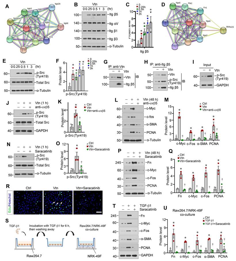 Macrophage promotes fibroblast activation and kidney fibrosis by ...