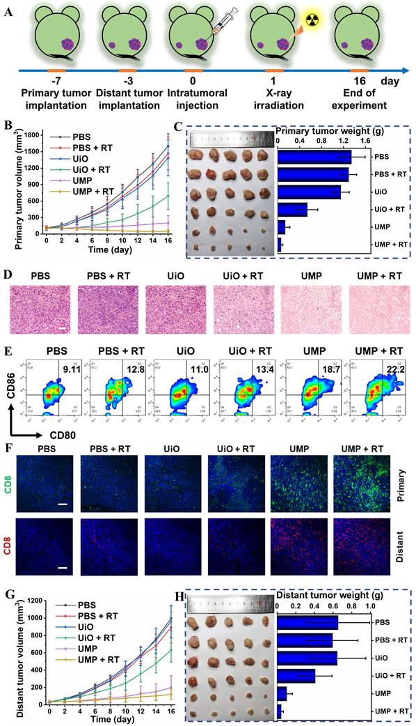 Immunogenic radiation therapy for enhanced anti-tumor immunity via core ...