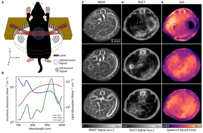 Multimodal assessment of non-alcoholic fatty liver disease with ...