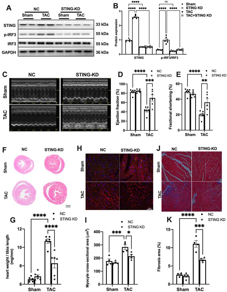 iNOS aggravates pressure overload-induced cardiac dysfunction via ...