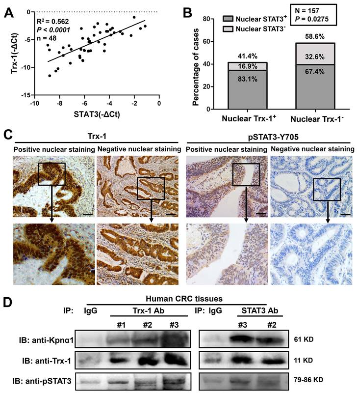 Nuclear translocation of thioredoxin-1 promotes colorectal cancer ...