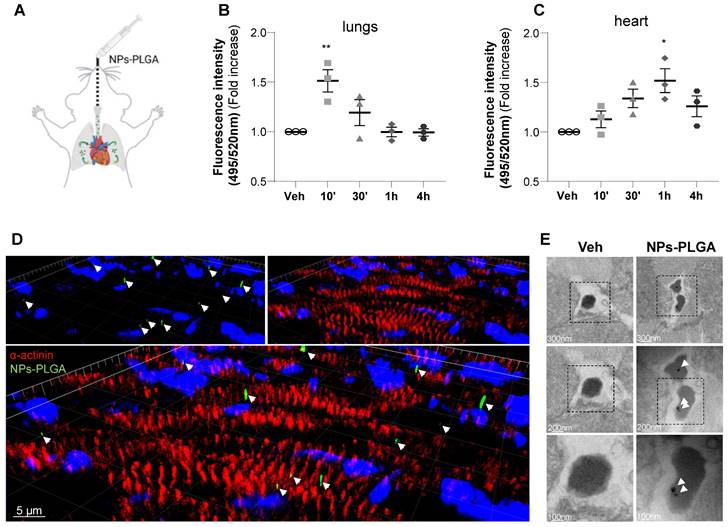 Inhalation of acidic nanoparticles prevents doxorubicin cardiotoxicity ...