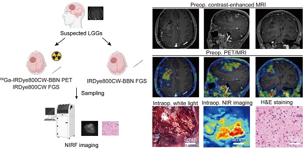 Volume 14, Issue 2 - thno