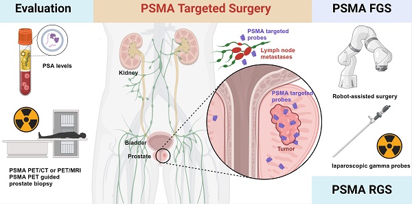 Prostate-specific membrane antigen-targeted surgery in prostate cancer ...